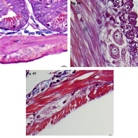Cross Sections Showing The Myenteric Plexus In Control Mice A Download Scientific Diagram
