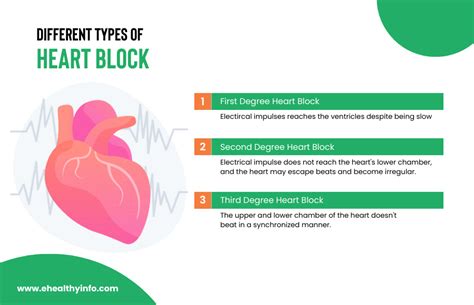 Heart Block Types Causes Symptoms And Treatment Options E Healthy