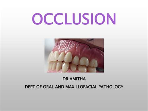 Occlusion Pptx