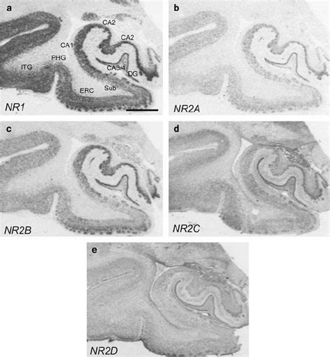 In Situ Hybridization Using 35 S Labeled Antisense Riboprobes For