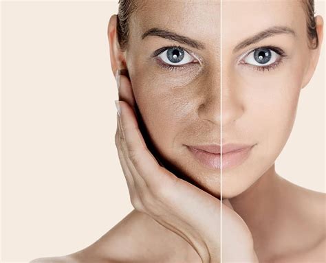 Fine Lines And Wrinkle Treatment Welona