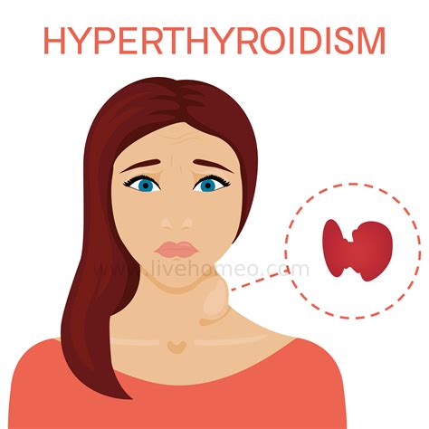 Get Relief From Hyperthyroid Disorders Livehomeo Livehomeo Homeo