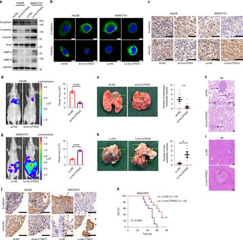 Lnc Cthcc Promotes Hcc Metastasis And Emt In Vitro And In Vivo A