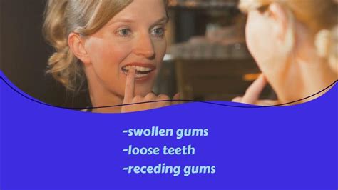 Gum Disease Treatment In Brisbane Youtube