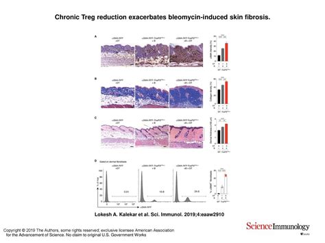Chronic Treg Reduction Exacerbates Bleomycin Induced Skin Fibrosis