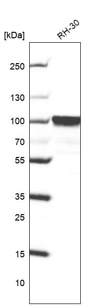 Rabbit Polyclonal Anti Foxp2 Antibody Buy For Research Highly