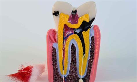 Proteins In Tooth Enamel Offer Window Into Human Wellness Reveals Research