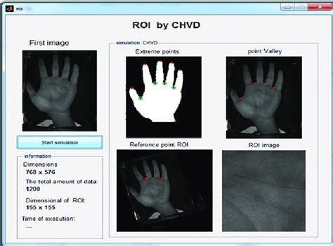 Gui Of Automatic Roi System By Chvd Algorithm Download Scientific Diagram