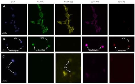 Journal Of Personalized Medicine Mdpi On Linkedin Circulating Tumor Cell Detection During