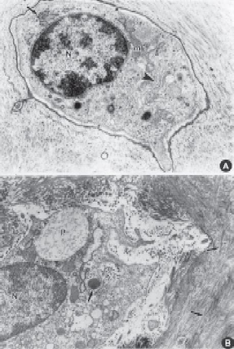 A Bone Matrix Decalcified By Immersion Collagen Fibers Arrow