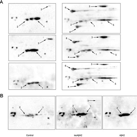 Effects Of Aβ42 And Isoaβ42 10 µm On Sh Sy5y Cells A Visualization