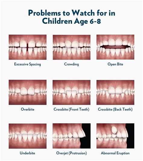 Orthodontic Issues Chart Booth Orthodontics