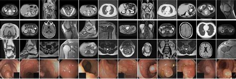 Figure 2 From Radimagegan A Multi Modal Dataset Scale Generative Ai For Medical Imaging
