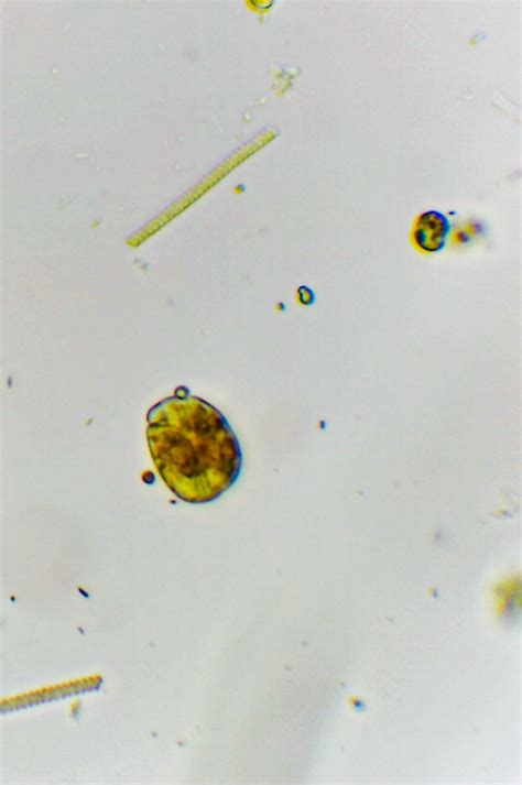 Need Help ID Dinoflagellate Microscope ID Reef Reef