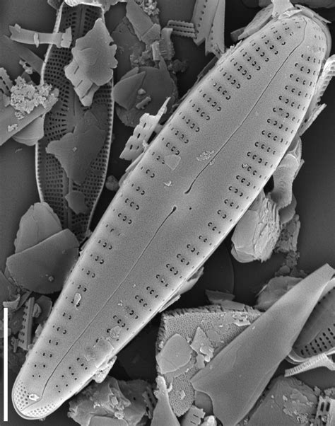 Gomphonema Incognitum Species Diatoms Of North America