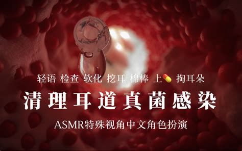 场景模拟清理耳道真菌感染 妖妖爱睡觉觉 妖妖爱睡觉觉 哔哩哔哩视频