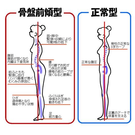 反り腰改善へ！タオルを使い骨盤を立てる座り方で腰痛予防｜整体ショーツ公式サイトはくだけ整体シリーズ