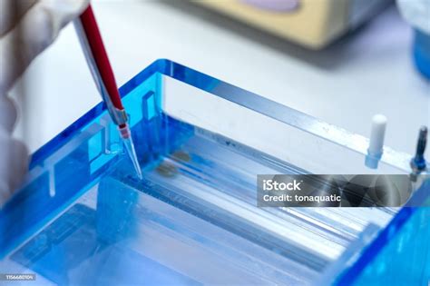 Dna 샘플 방법에 대한 분자 기술 젤 전기 동공은 유전 코드를 해독합니다 실험실에서 생화학 및 임상 화학 분자 구조에 대한