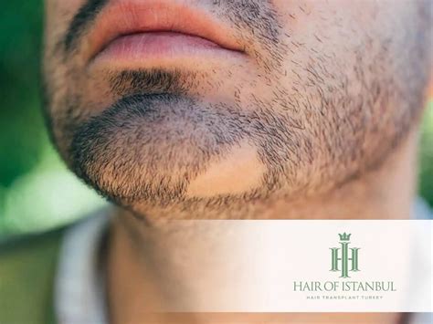 Bald Spot In Beard Healing Solutions And Tips