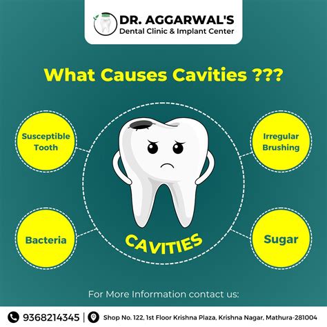 what causes cavities dental clinic dental hospital flossing