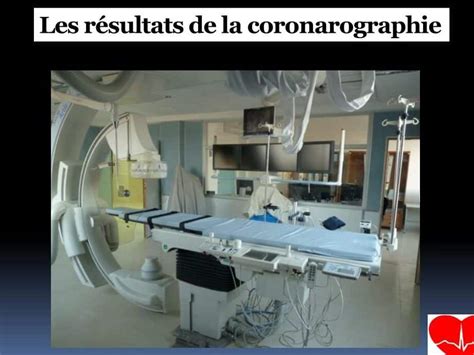 Comprendre Léchelle De Killip Pour évaluer Linsuffisance Cardiaque
