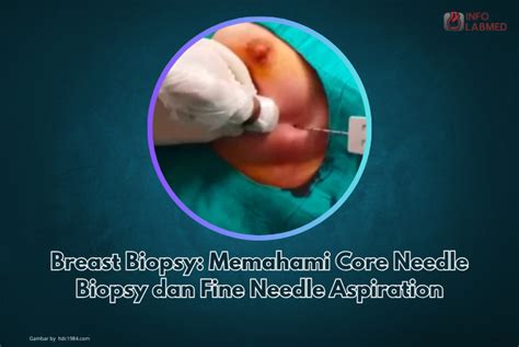 Breast Biopsy Memahami Core Needle Biopsy Dan Fine Needle Aspiration