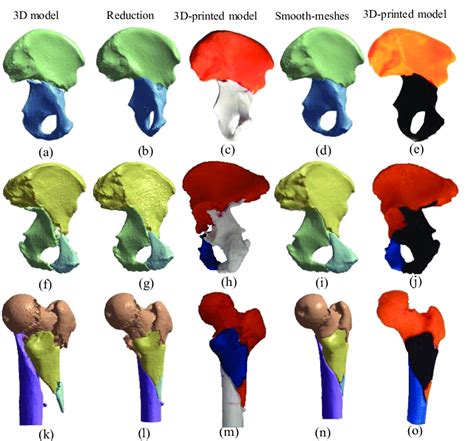 Three Clinical Cases Of Simulated Mesh Overlapping Download Scientific Diagram