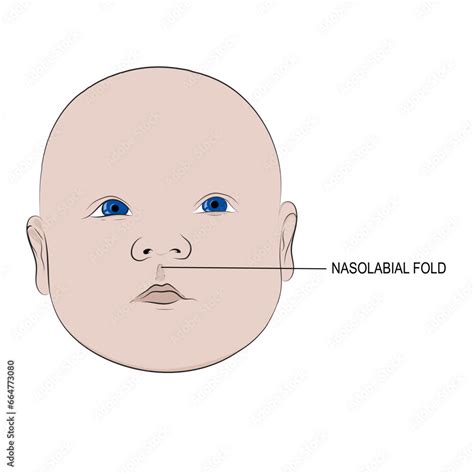 Nasolabial Fold Or Nasolabial Fold The Line That Descends From The Wing