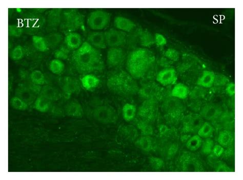 Double Labeling Immunofluorescence For Trpv1 Cgrp A C And D F And Download Scientific