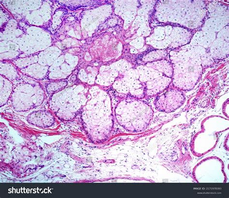 Sudoriferous Glands