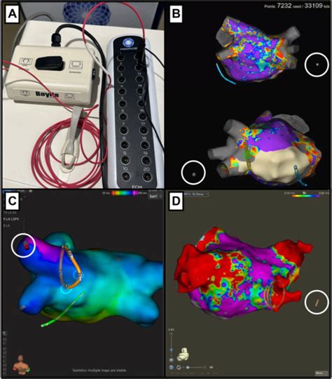 Novel Methodology For Nonfluoroscopic Wire Visualization During Pulsed