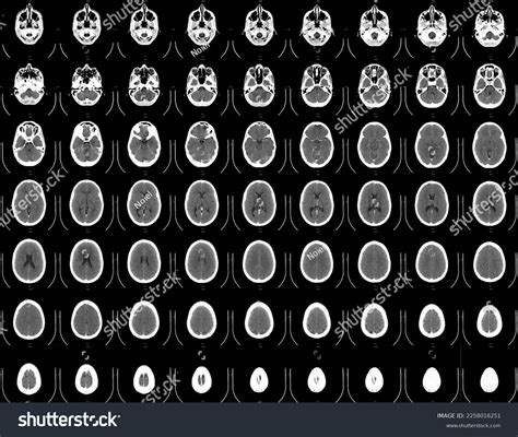 Horizontal Sections Complete Human Brain Scan Stock Photo Shutterstock