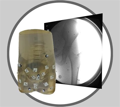 Pdf Gold Standard Dataset For 3d 2d Registration