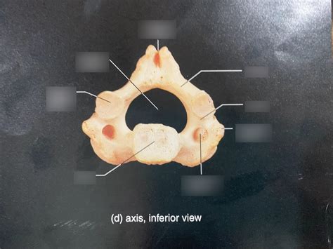 Axis Inferior View Diagram Quizlet