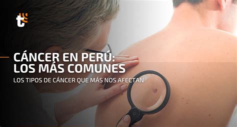 Cáncer En El Perú Conozca Los Tipos De Cáncer Más Frecuentes En El