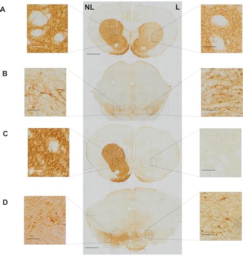 The 6 Hydroxydopamine Rat Model Of Parkinsons Disease Video Jove