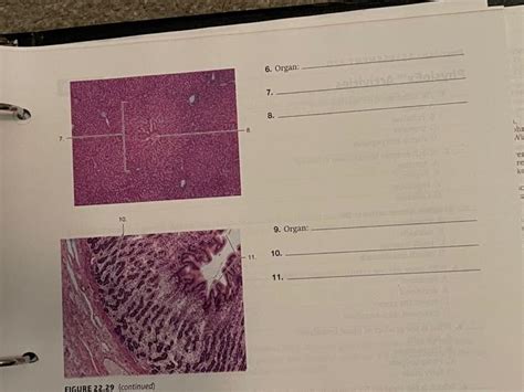 Solved Anatomy Of The Digestive System Complete The Labeling Chegg