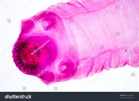 Taenia Pisiformis Slide