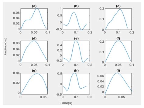 Diagnostics Free Full Text Advanced Time Frequency Methods For Ecg Waves Recognition