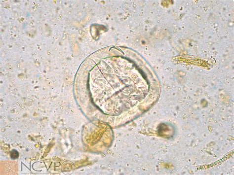 Tapeworm Ova
