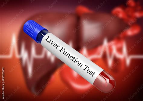 Blood Sample In Test Tube For Examination Of Liver Function In