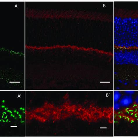 Hrg4 Unc119 Is Expressed In The Outer Plexiform Layer Of Murine Download Scientific Diagram