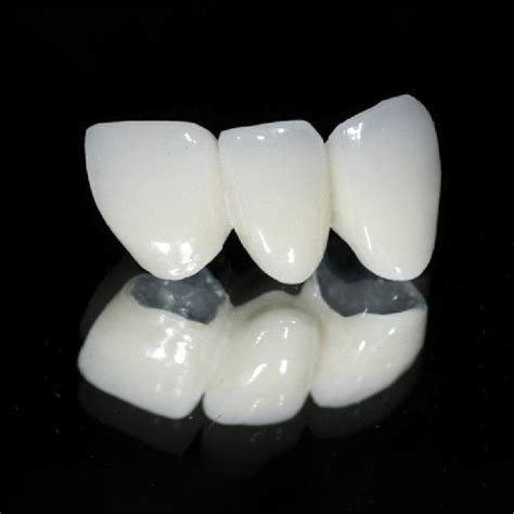 China Dental Lab Pfm Crowns And Bridge Manufacturers Suppliers Factory
