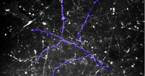 Uchicago Researchers Identify Neural Circuit Implicated In Fear