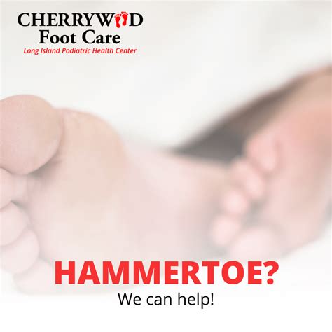 Podiatrist Near Amityville Ny Cherrywood Foot Care