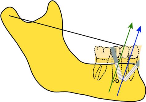 Same Direction Of Loading Axis Green Arrow And Constraint Axis Blue Download Scientific