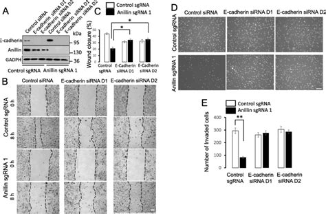 Downregulation Of E Cadherin Expression Reverses The Decreased Motility