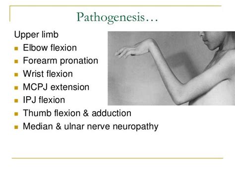 Principles Of Management Of Volkmanns Contracture