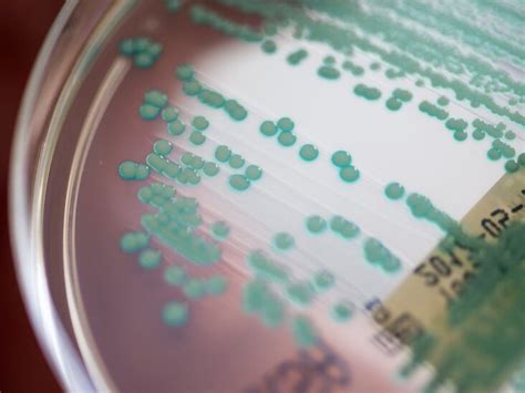 Mrsa As A Cause Of Lung Infection Including Airway Staphylococcus