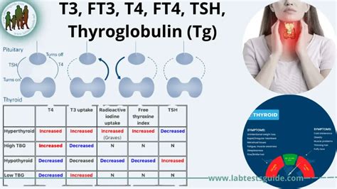 Thyroid Profile Tests Purpose Procedure Results And More